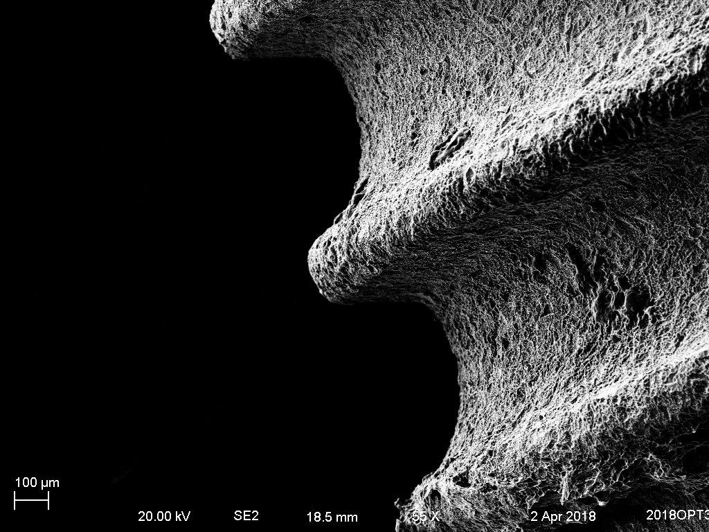 Dental Implant Wallpapers - Top Free Dental Implant Backgrounds ...