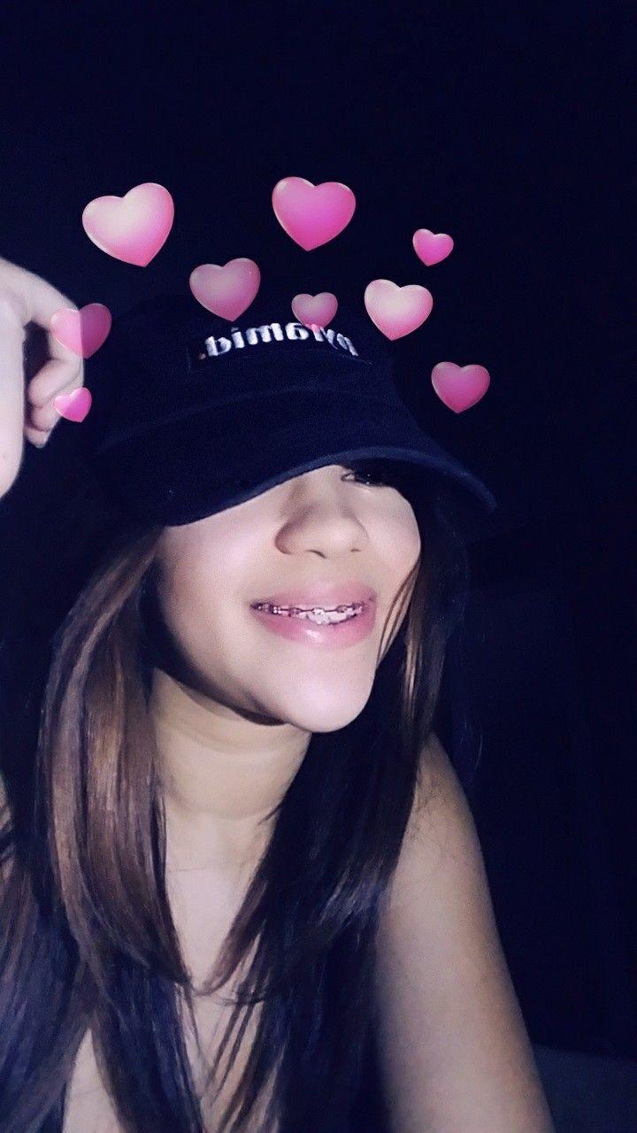 Braces Wallpapers - Top Free Braces Backgrounds - WallpaperAccess