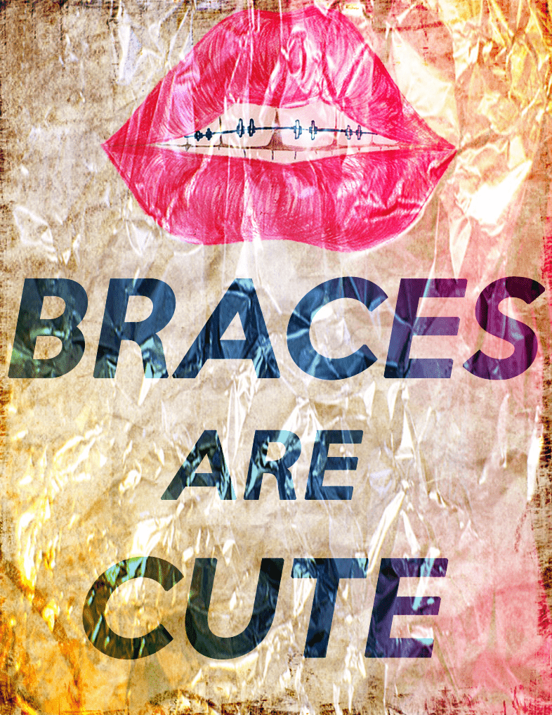 Braces Wallpapers - Top Free Braces Backgrounds - WallpaperAccess