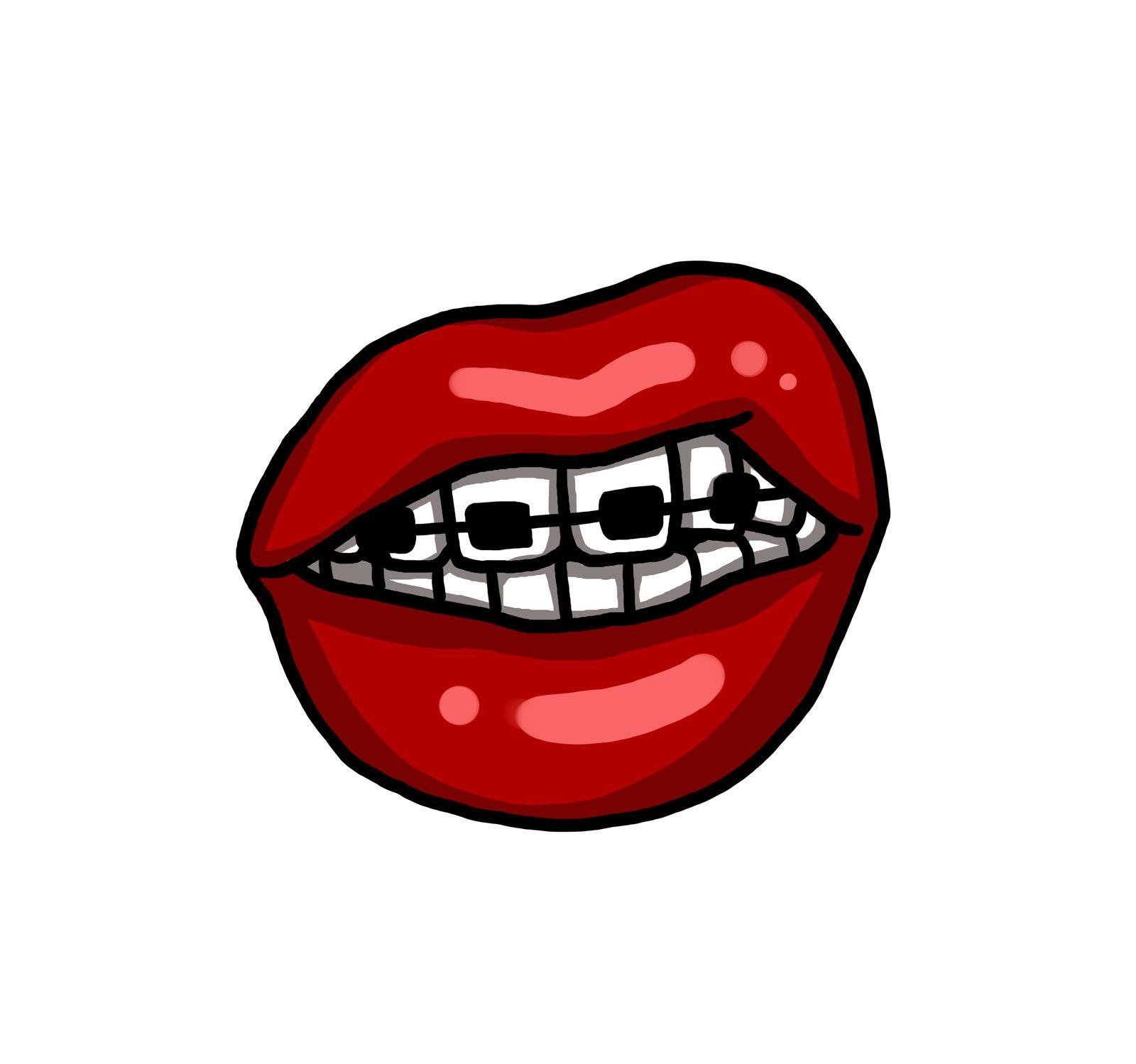 Braces Wallpapers - Top Free Braces Backgrounds - WallpaperAccess