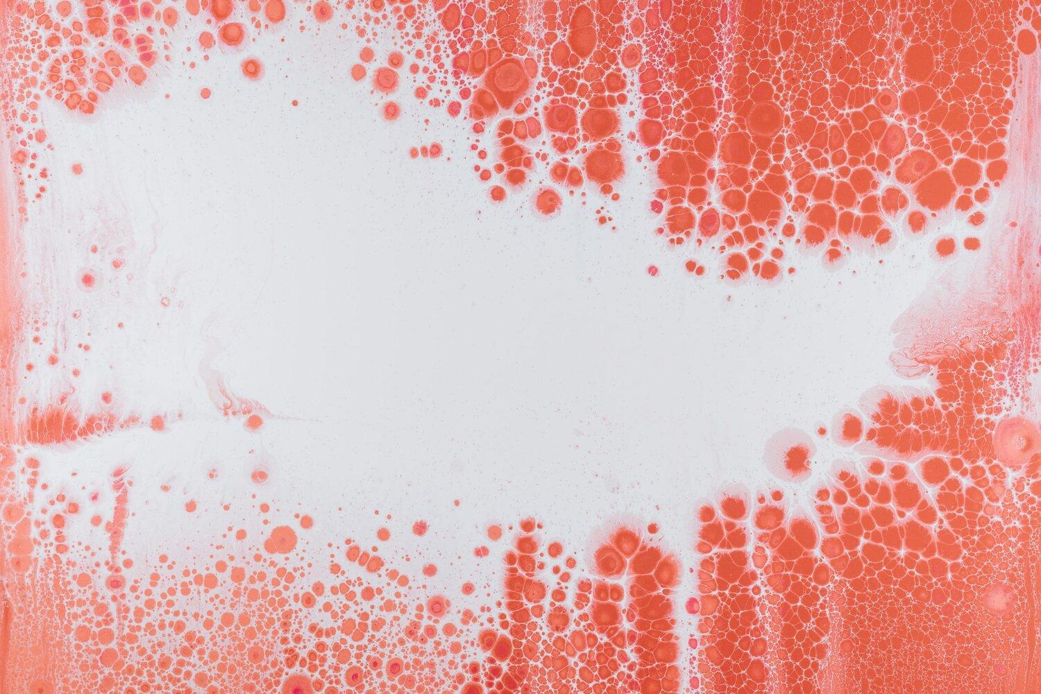 Anemia Wallpapers - Top Free Anemia Backgrounds - WallpaperAccess