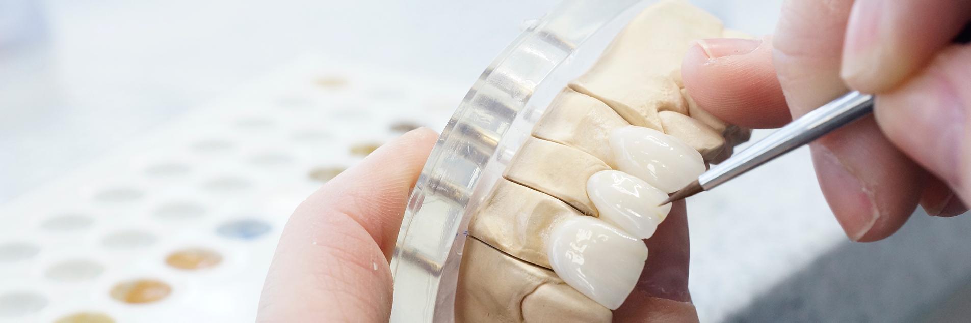 Dental Laboratory Wallpapers - Top Free Dental Laboratory Backgrounds - WallpaperAccess