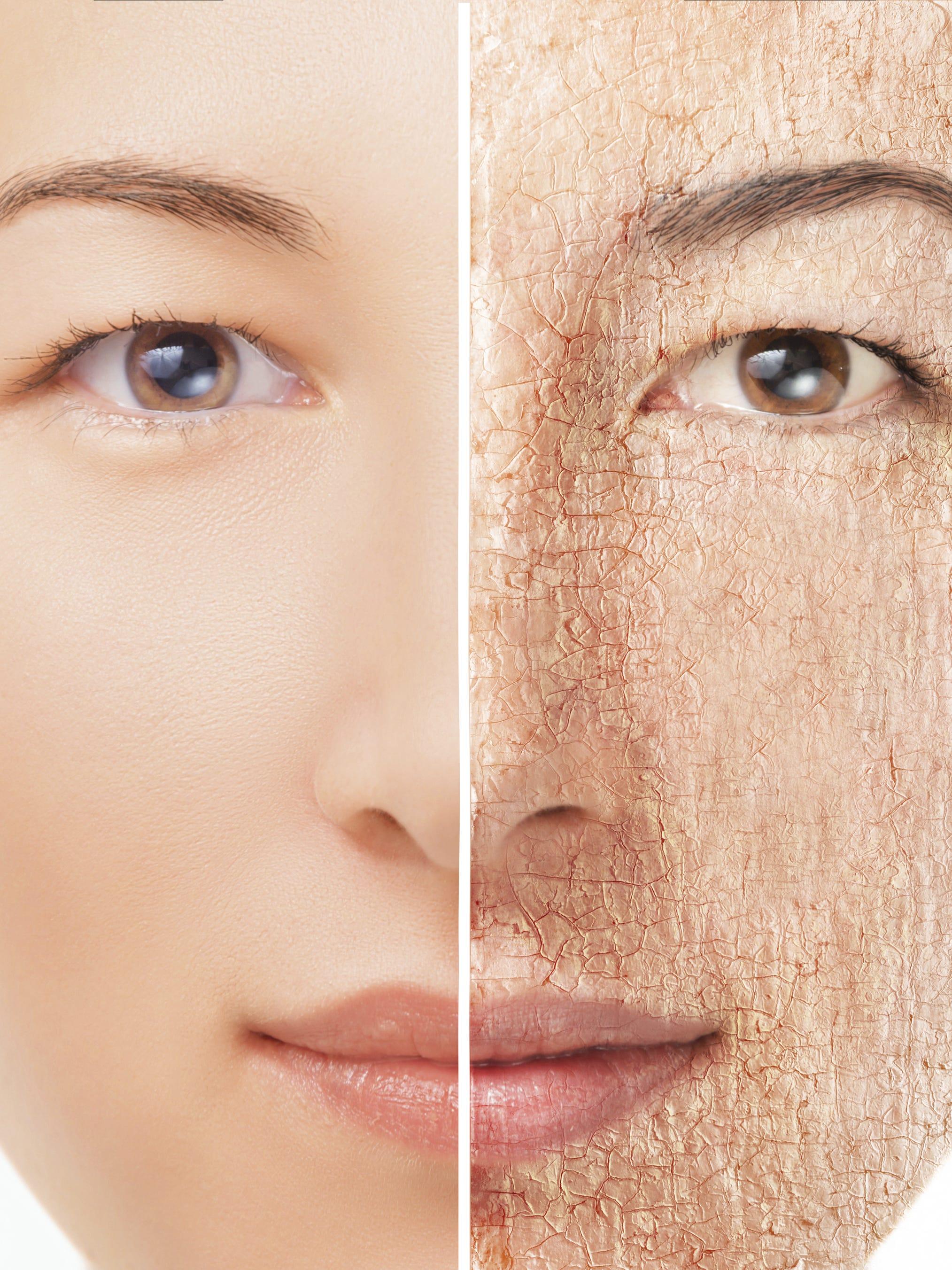 Dry Skin Wallpapers - Top Free Dry Skin Backgrounds - WallpaperAccess