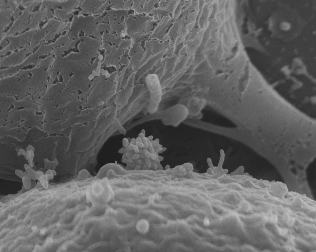 Virology Wallpapers - Top Free Virology Backgrounds - WallpaperAccess