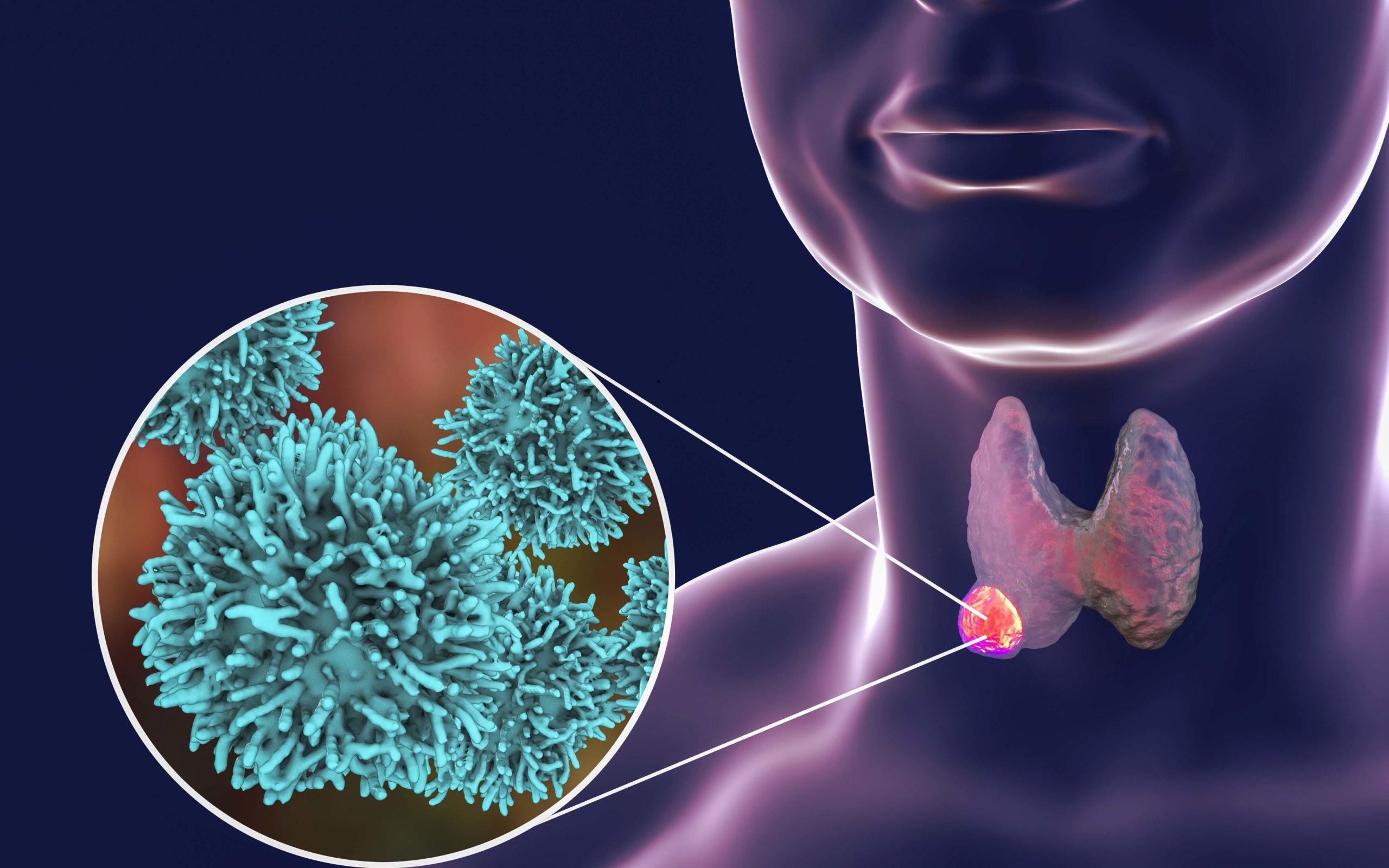 Thyroid Wallpapers - Top Free Thyroid Backgrounds - WallpaperAccess