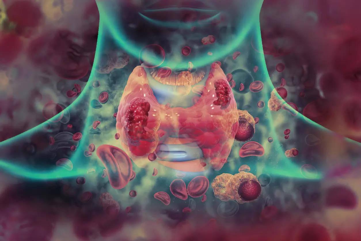 Thyroid Wallpapers - Top Free Thyroid Backgrounds - WallpaperAccess