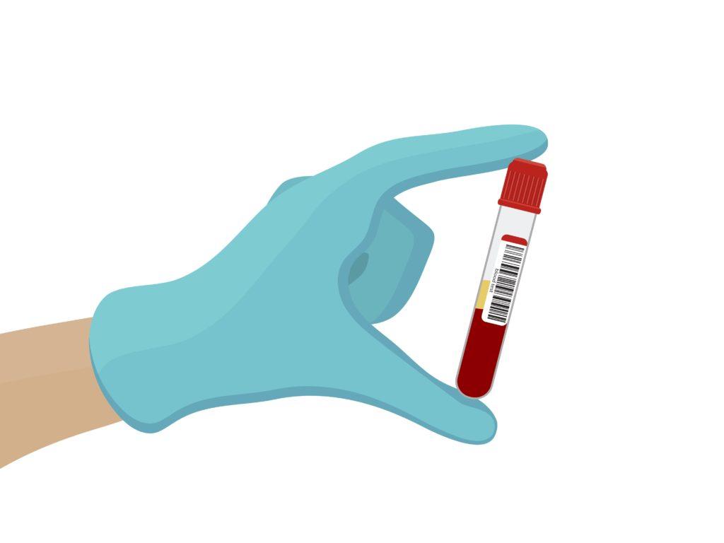 Blood Collection Wallpapers - Top Free Blood Collection Backgrounds ...