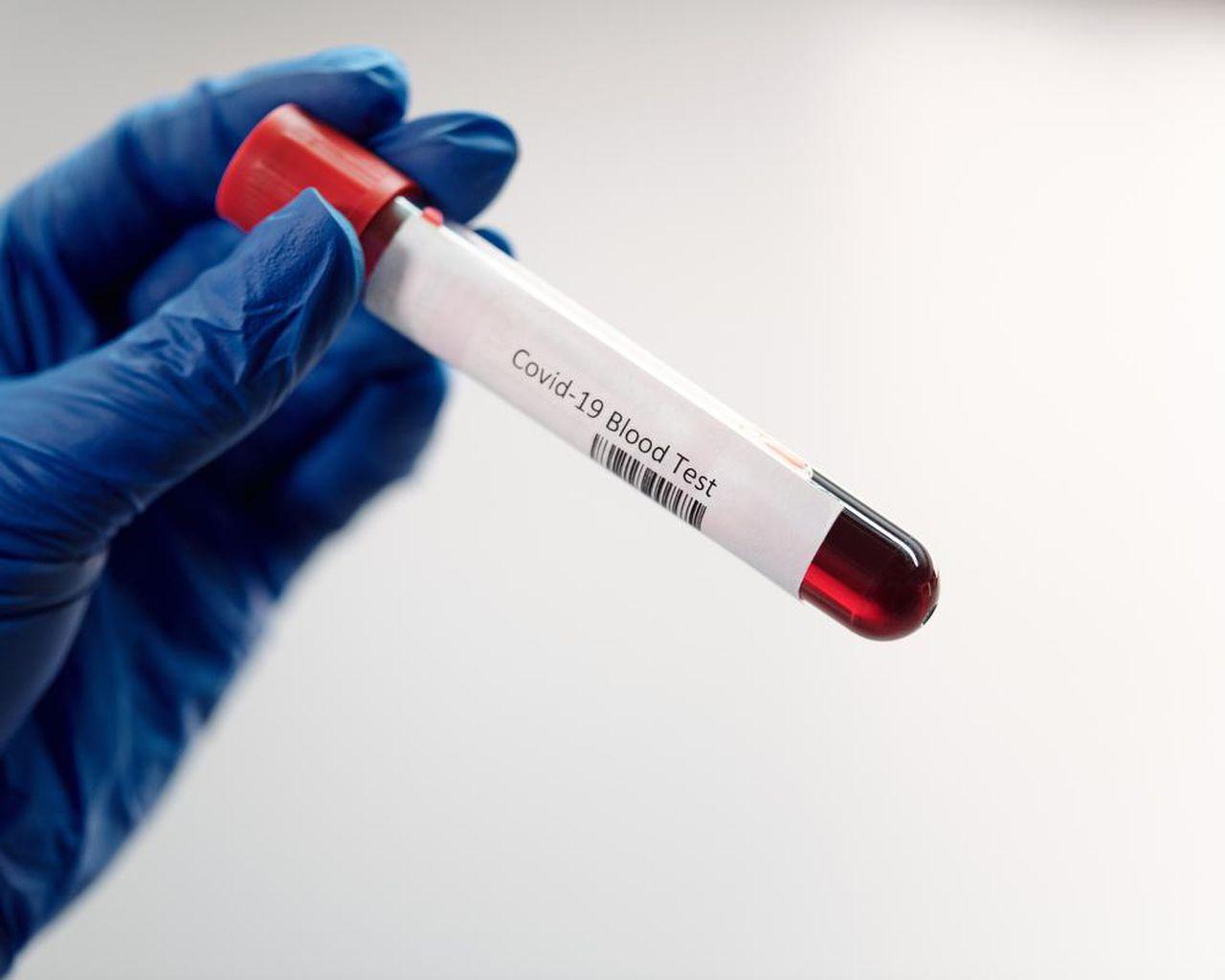 Blood Collection Wallpapers - Top Free Blood Collection Backgrounds ...