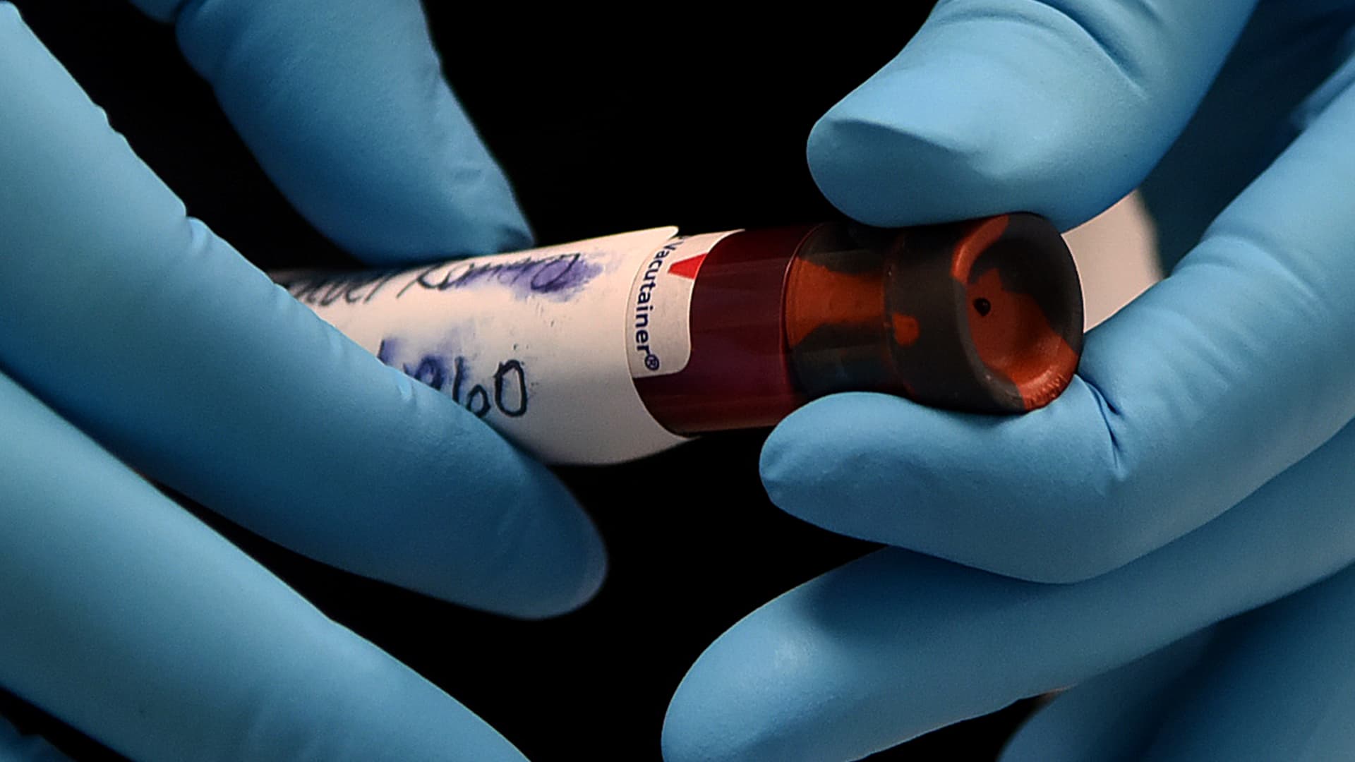 Blood Collection Wallpapers - Top Free Blood Collection Backgrounds ...