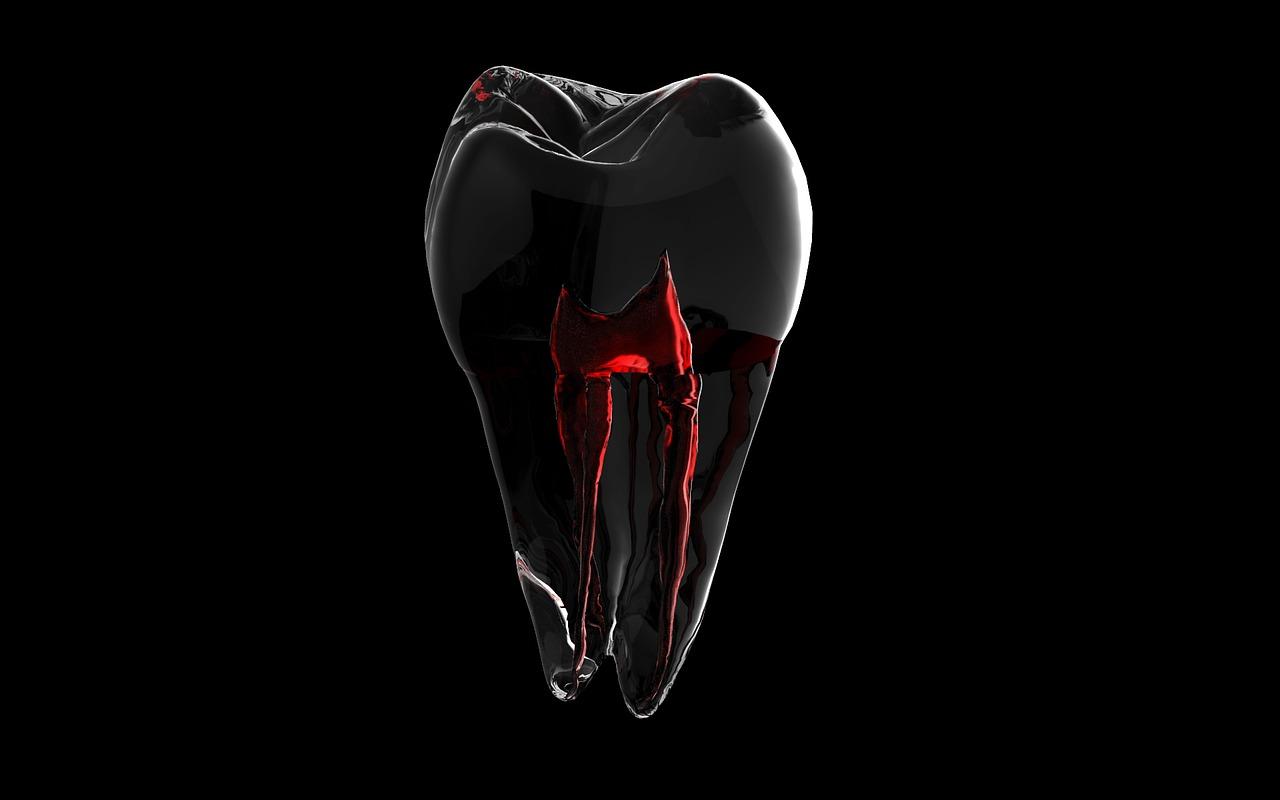Root Canal Treatment Wallpapers - Top Free Root Canal Treatment ...