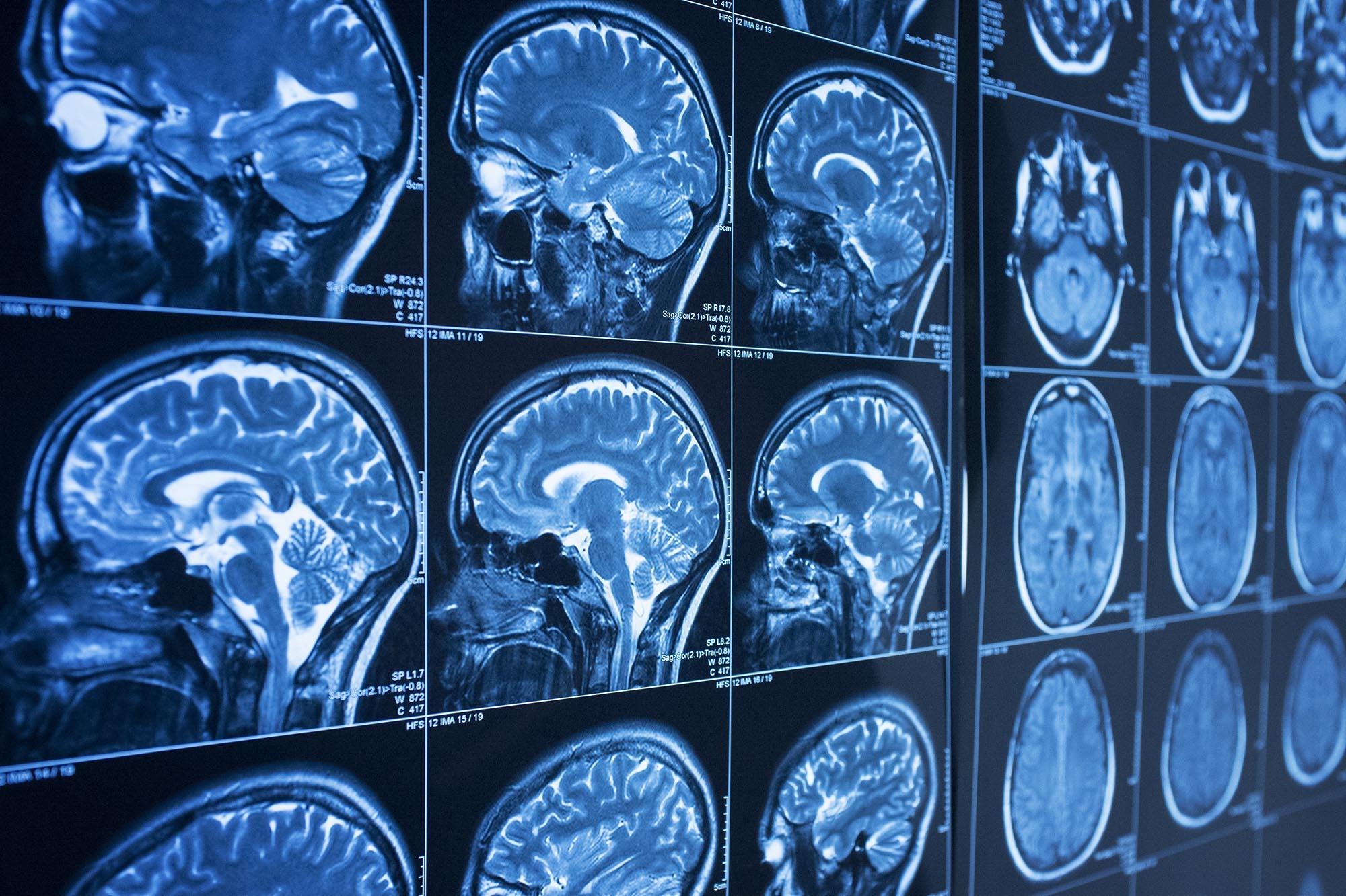 Calcium Wallpapers - Top Free Calcium Backgrounds - WallpaperAccess