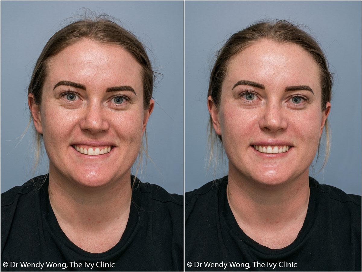 Filler Wallpapers - Top Free Filler Backgrounds - WallpaperAccess