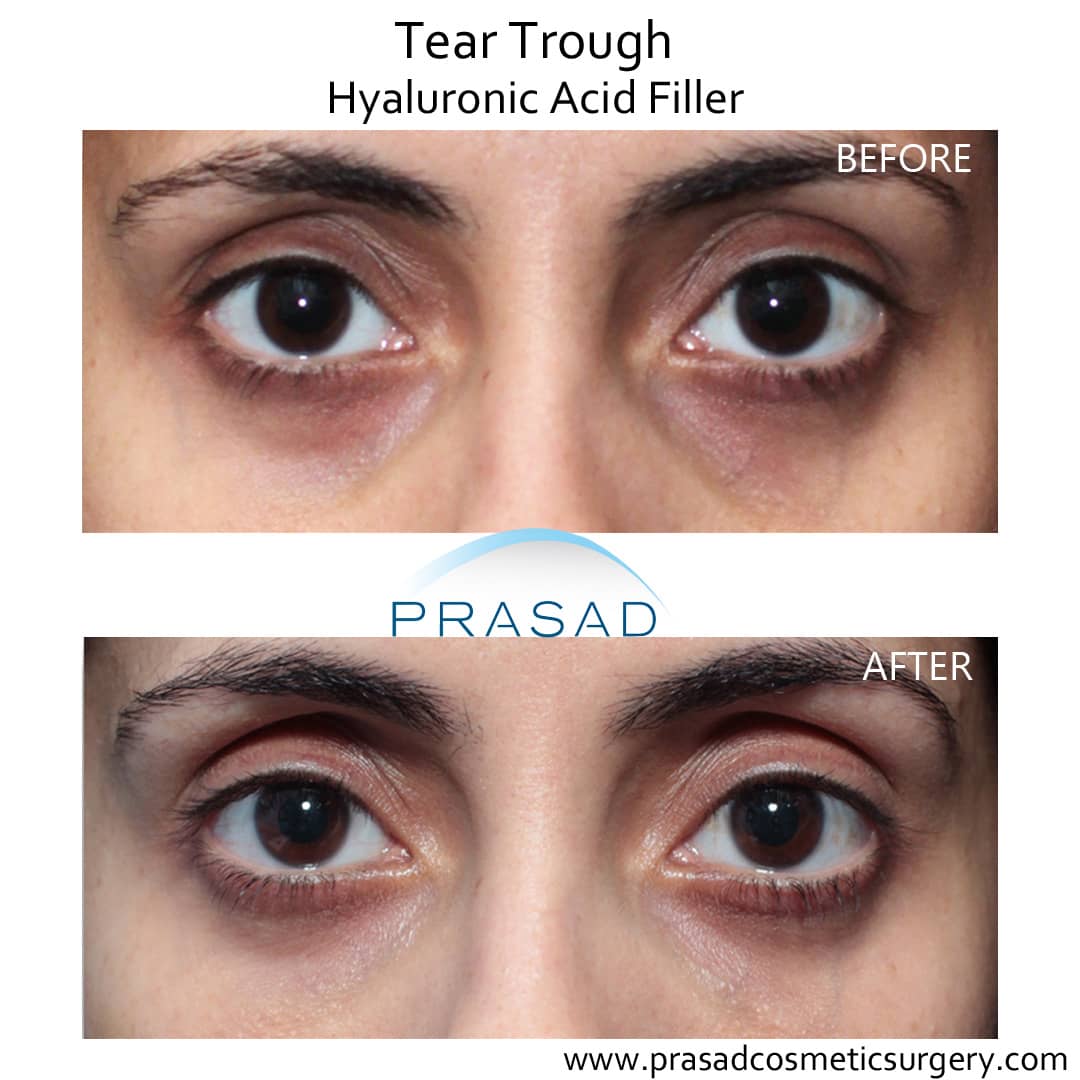 Filler Wallpapers - Top Free Filler Backgrounds - WallpaperAccess