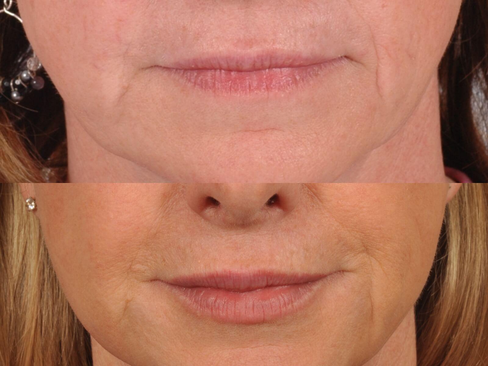 Filler Wallpapers - Top Free Filler Backgrounds - WallpaperAccess