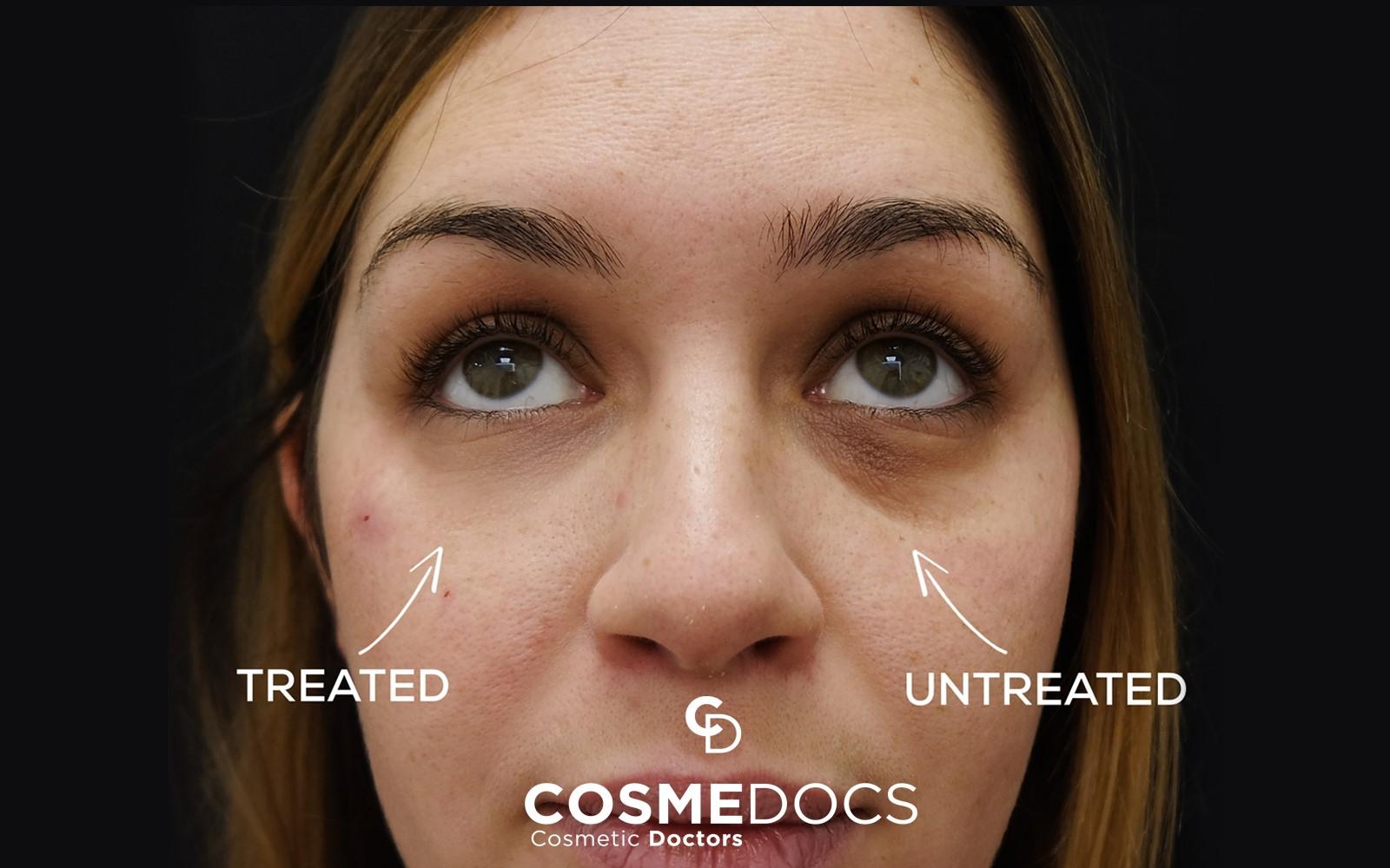 Filler Wallpapers - Top Free Filler Backgrounds - WallpaperAccess