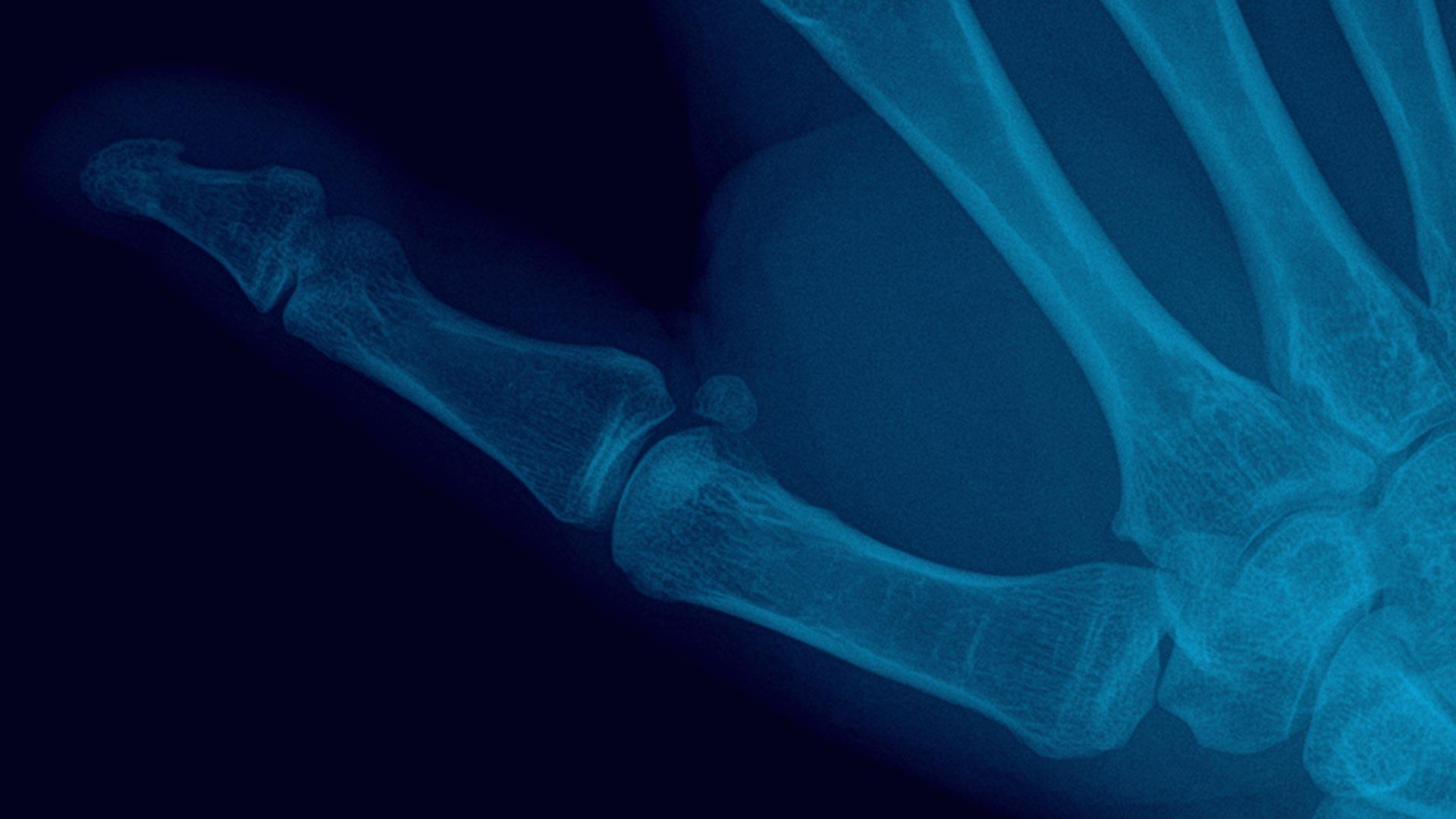 CT Scan Wallpapers - Top Free CT Scan Backgrounds - WallpaperAccess