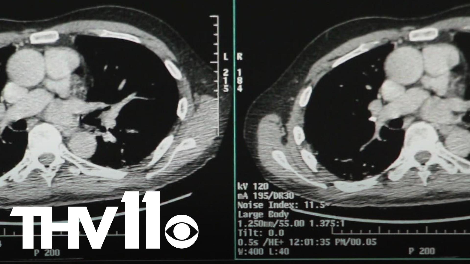 CT Scan Wallpapers - Top Free CT Scan Backgrounds - WallpaperAccess