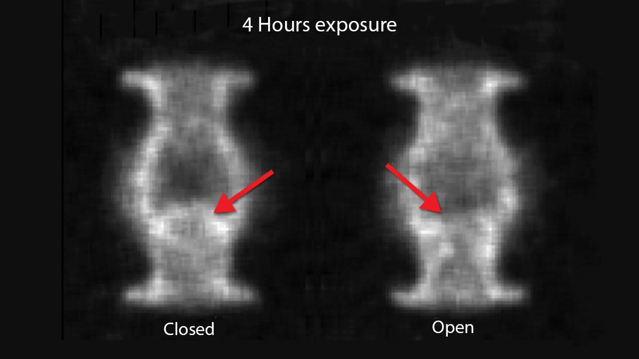 CT Scan Wallpapers - Top Free CT Scan Backgrounds - WallpaperAccess