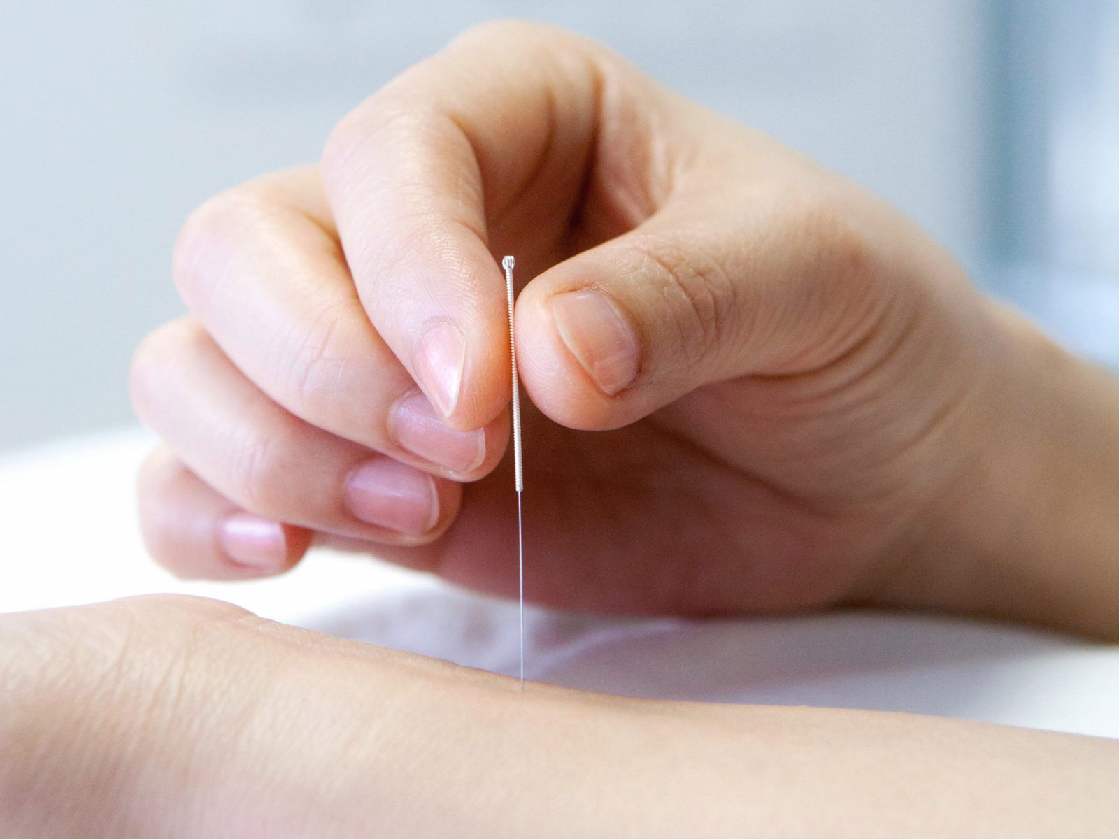 Acupuncture Wallpapers - Top Free Acupuncture Backgrounds - WallpaperAccess