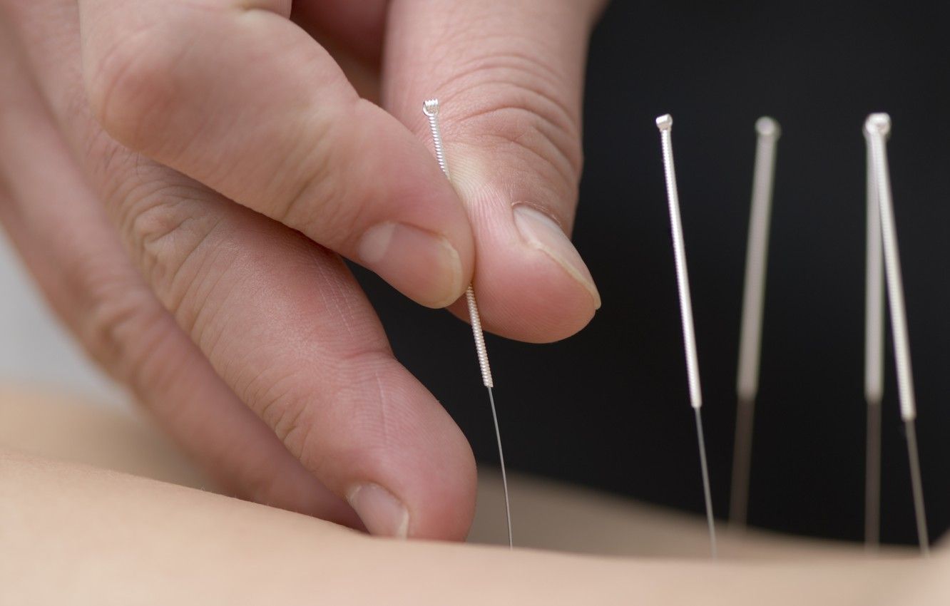 Acupuncture Wallpapers - Top Free Acupuncture Backgrounds - WallpaperAccess