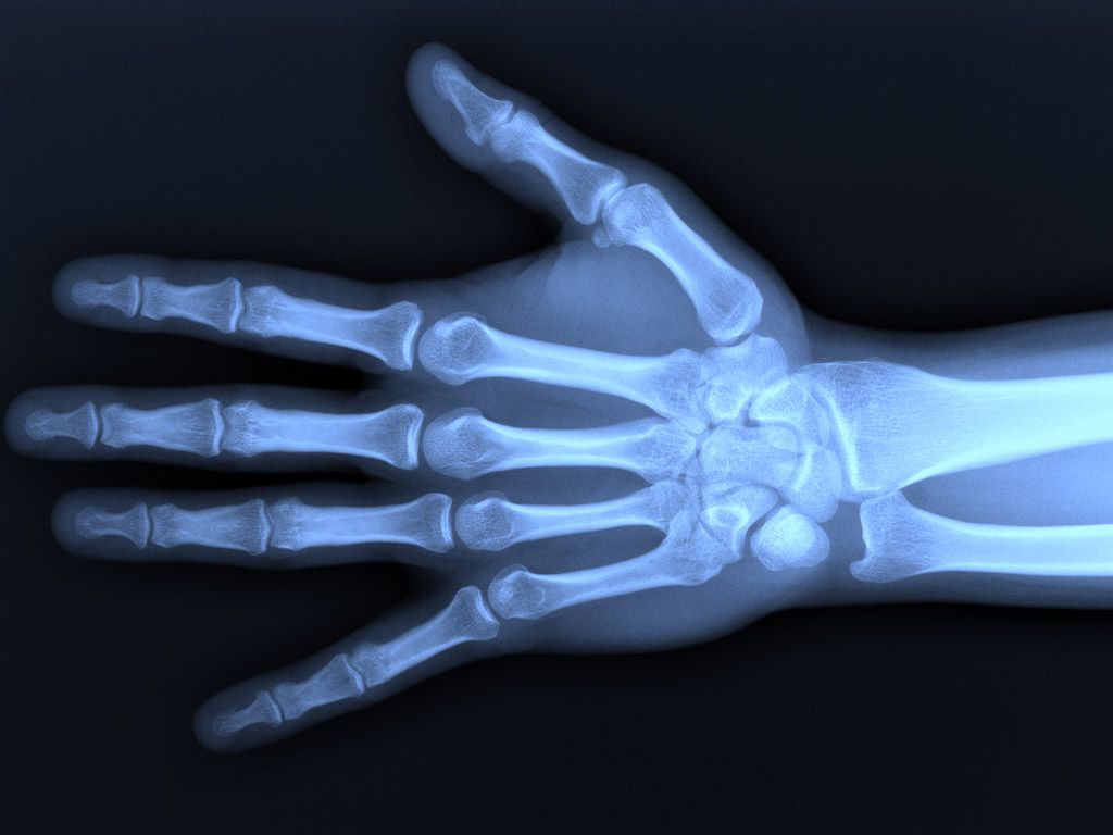 Orthopaedic Wallpapers - Top Free Orthopaedic Backgrounds - WallpaperAccess