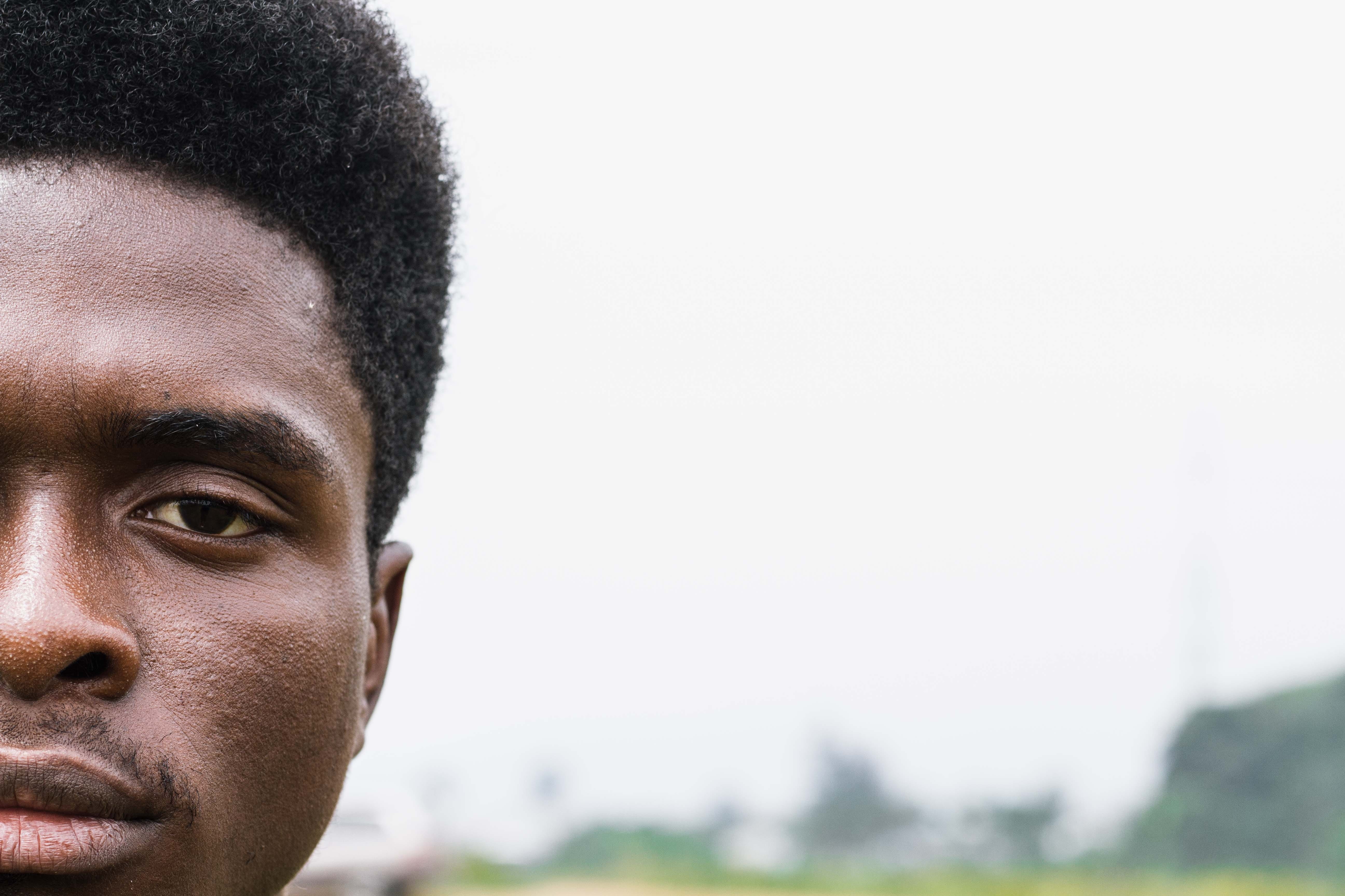 Pimple Wallpapers - Top Free Pimple Backgrounds - WallpaperAccess