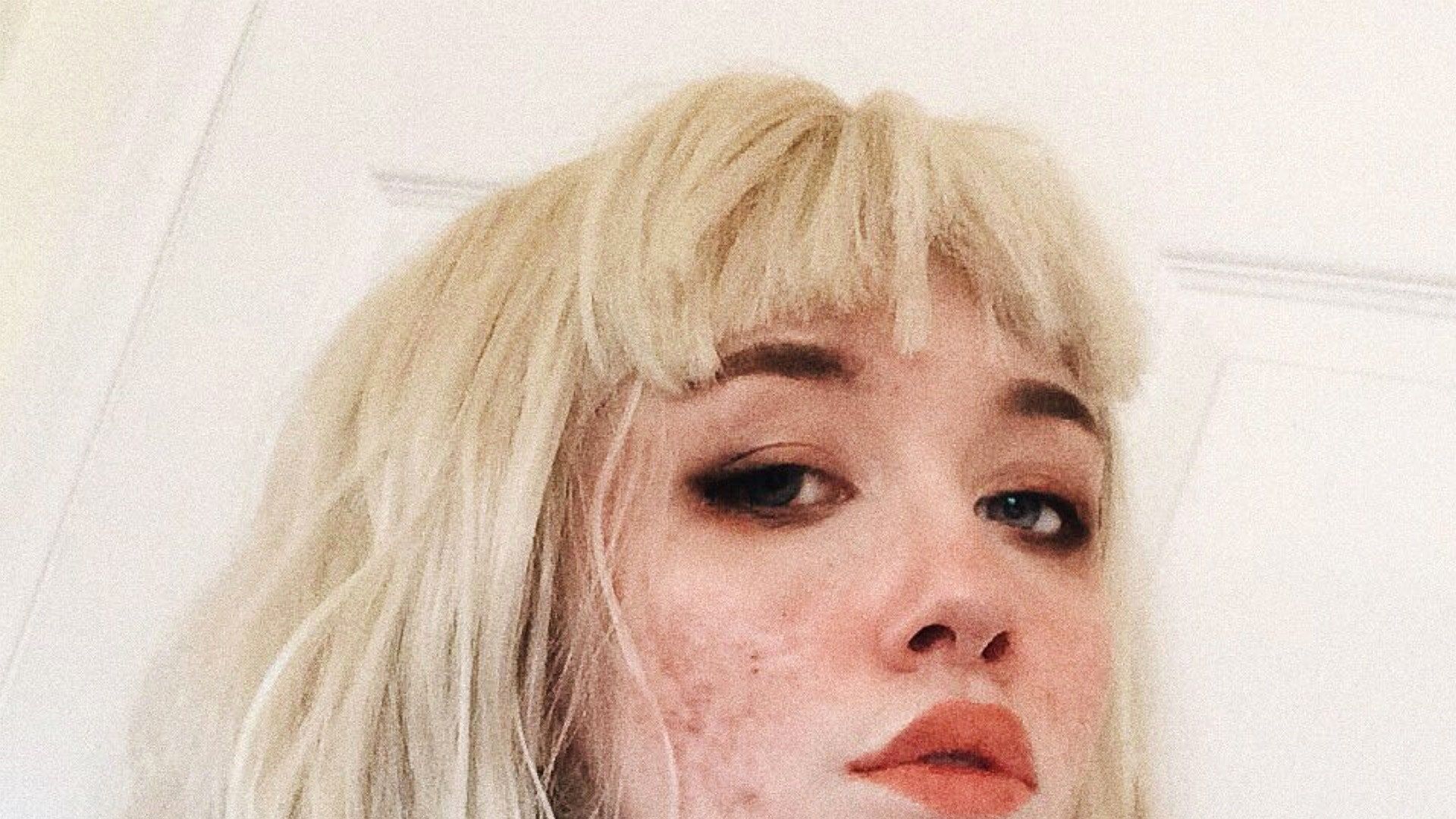 Pimple Wallpapers - Top Free Pimple Backgrounds - WallpaperAccess