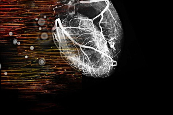 ECG Wallpapers - Top Free ECG Backgrounds - WallpaperAccess