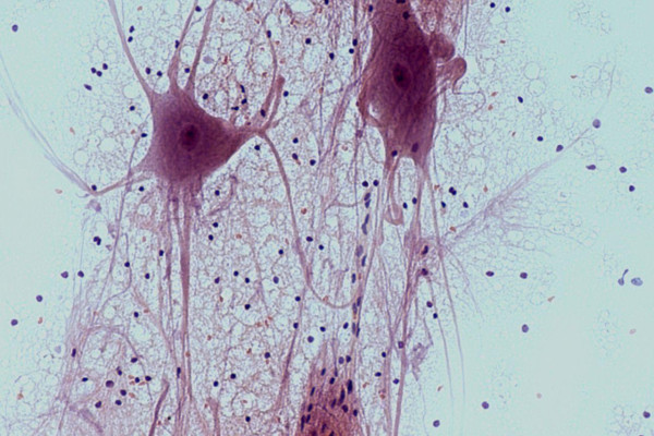 Pathology Wallpapers - Top Free Pathology Backgrounds - WallpaperAccess